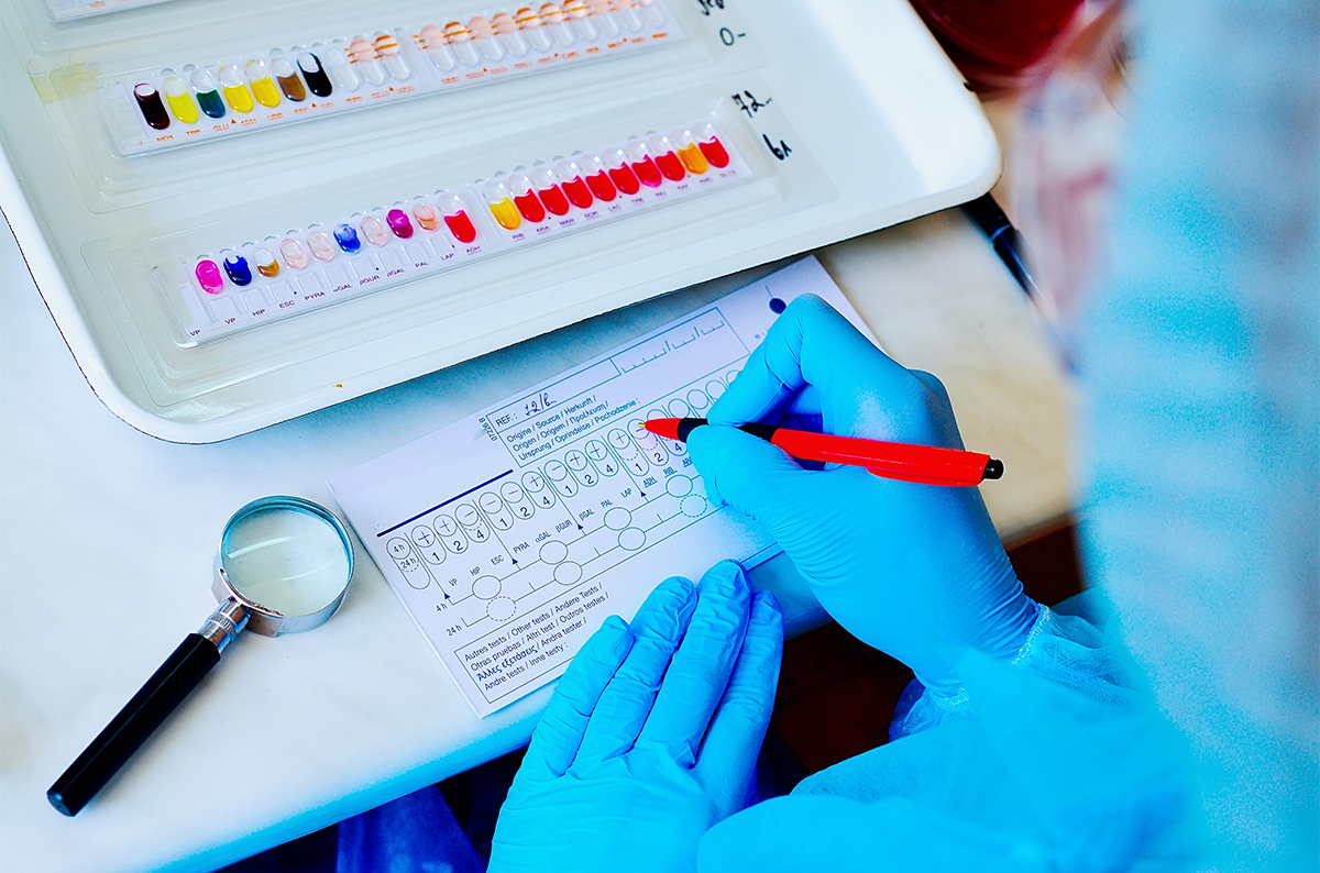 Analytical Profile Index: 7 Fascinating Benefits in Microbiology